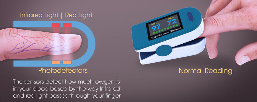 Pulse Oximeter: How It Measures Blood Oxygen (SpO2) at Home & in ...